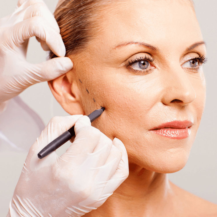 Plastinė chirurgija